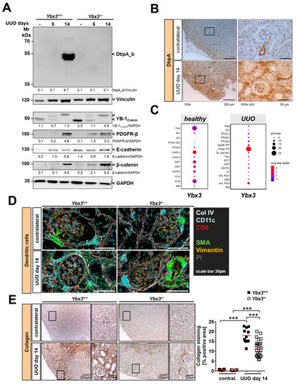 Cold Shock Domain Protein DbpA Orchestrates Tubular Cell Damage and ...