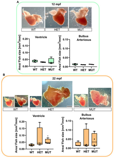 Characterization of the Zebrafish Elastin a (elnasa12235) Mutant: A New ...