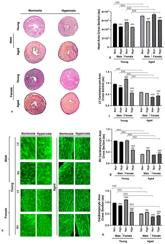 Influence of Age on Hyperoxia-Induced Cardiac Pathophysiology in Type 1 ...