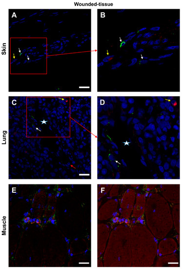 In Situ Identification of Both IL-4 and IL-10 Cytokine–Receptor ...