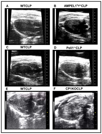 Role of Pellino-1 in Inflammation and Cardioprotection following Severe ...