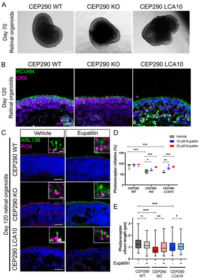 Cells | Free Full-Text | Eupatilin Improves Cilia Defects in Human ...
