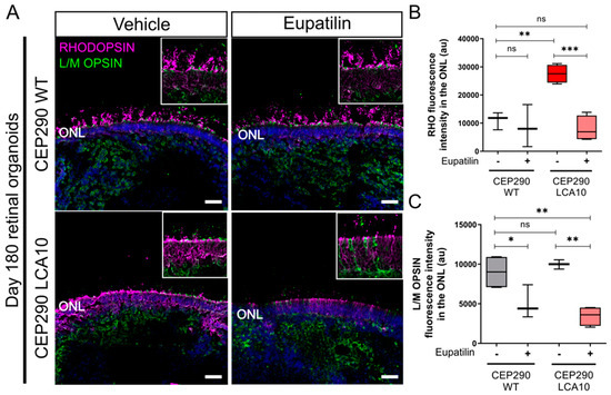 Cells | Free Full-Text | Eupatilin Improves Cilia Defects in Human ...