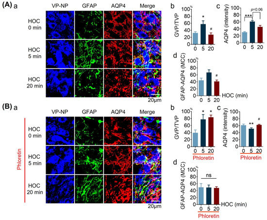 Cells | Free Full-Text | Interactions between the Astrocytic Volume-Regulated Anion Channel and ...