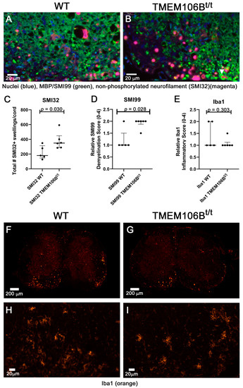 TMEM106B Puncta Is Increased in Multiple Sclerosis Plaques, and Reduced ...