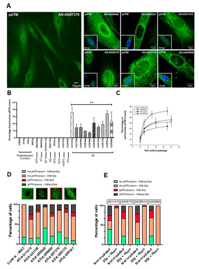 Toward an Early Diagnosis for Alzheimer’s Disease Based on the ...