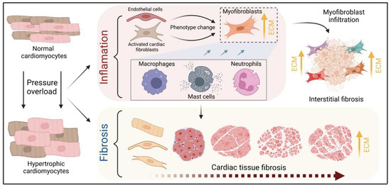 The Microenvironment of the Pathogenesis of Cardiac Hypertrophy