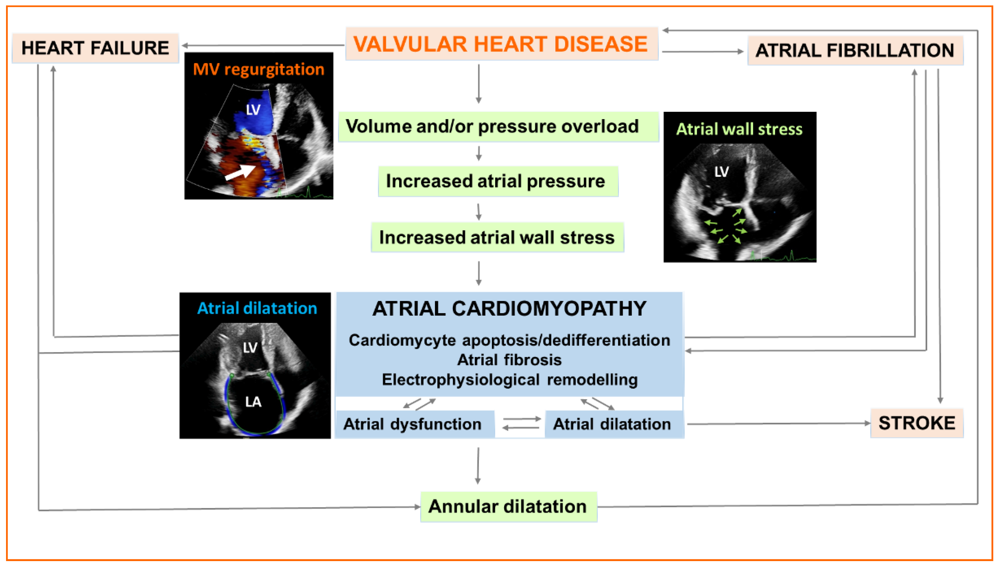 Cells Free Full Text Atrial Cardiomyopathy In Valvular Heart