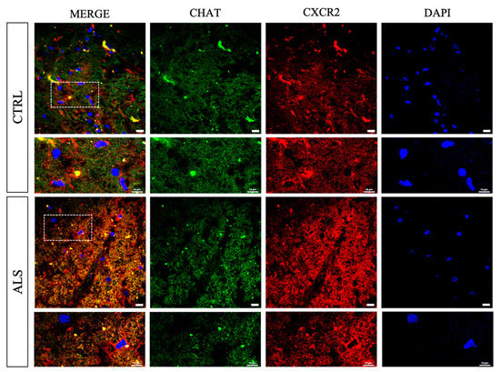 CXCR2 Is Deregulated in ALS Spinal Cord and Its Activation Triggers ...