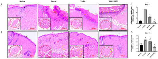 Therapeutic Effects and Underlying Mechanism of SOCS-com Gene ...