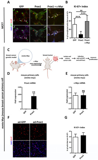 Prox1 Suppresses the Proliferation of Breast Cancer Cells via Direct ...