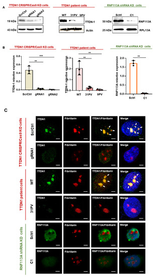 Cells | Free Full-Text | Ribosomal Dysfunction Is a Common ...