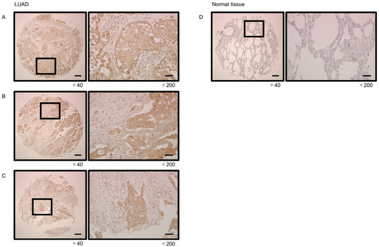 The Molecular Pathogenesis of Tumor-Suppressive miR-486-5p and miR-486 ...