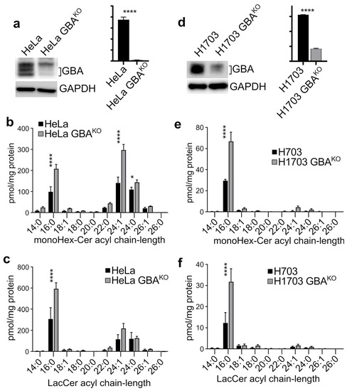 GBA Regulates EMT/MET and Chemoresistance in Squamous Cell Carcinoma ...