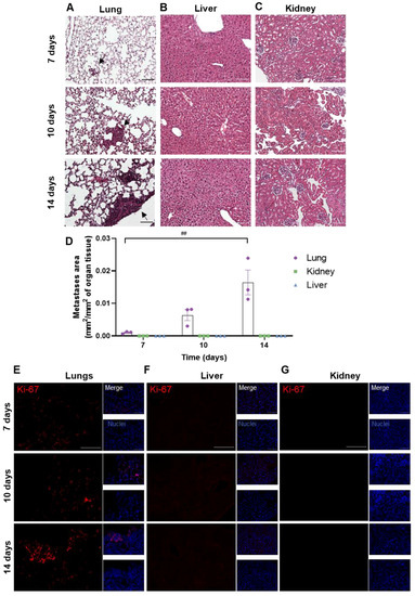 Breast Cancer Brain Metastases: Implementation and Characterization of ...