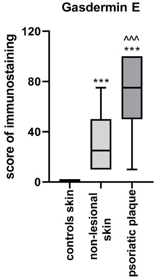 Gasdermin E (GSDME)—A New Potential Marker of Psoriasis and Its ...