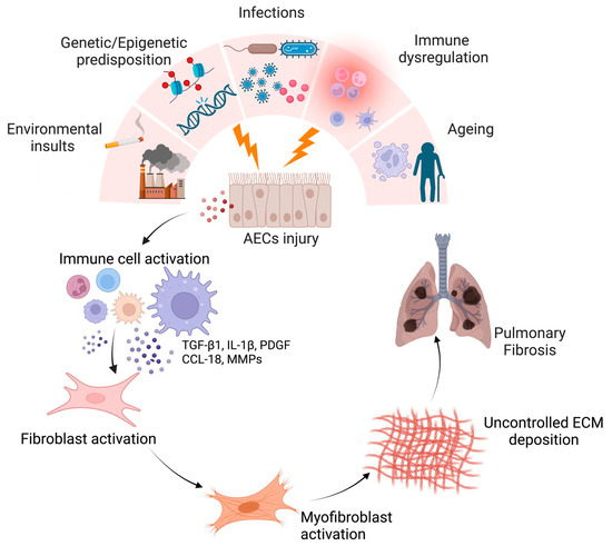 Macrophage Implication in IPF: Updates on Immune, Epigenetic, and ...