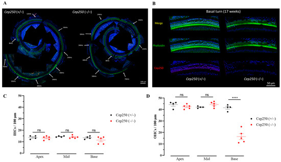 Cells | Free Full-Text | Novel Variant in CEP250 Causes Protein ...