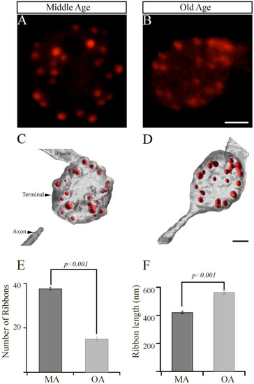 The Effects of Aging on Rod Bipolar Cell Ribbon Synapses