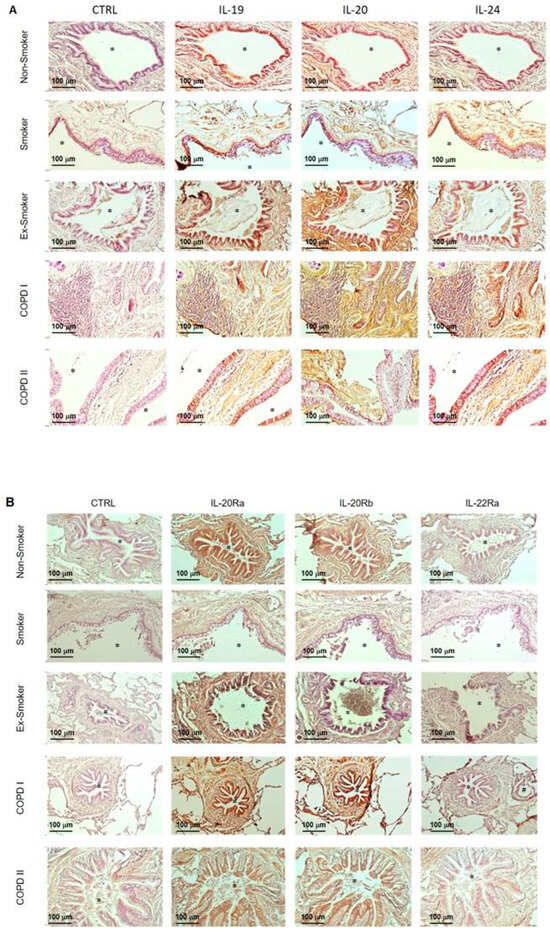 IL-20 Cytokines Are Involved in the Repair of Airway Epithelial Barrier ...
