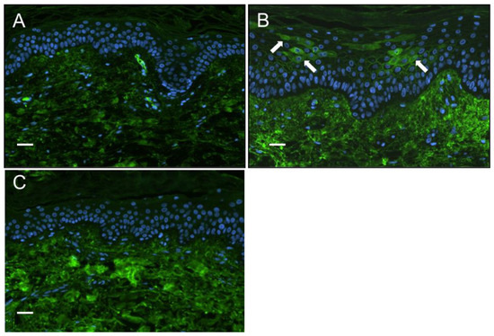 Cells | Free Full-Text | Autoantibodies Which Bind to and Activate ...