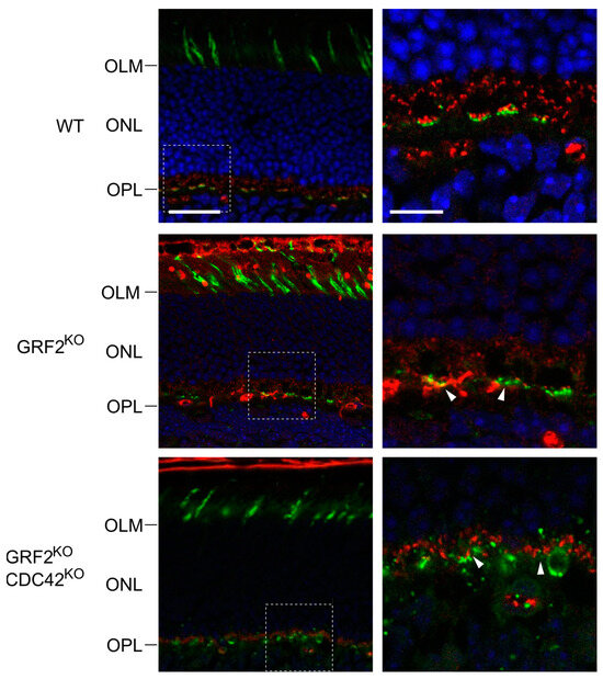 GRF2 Is Crucial for Cone Photoreceptor Viability and Ribbon Synapse ...