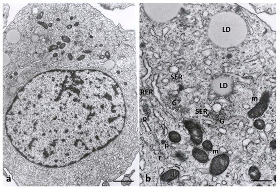 Heavy Metals in Follicular Fluid Affect the Ultrastructure of the Human ...
