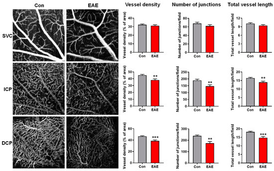 Non-Invasive Evaluation of Retinal Vascular Alterations in a Mouse ...