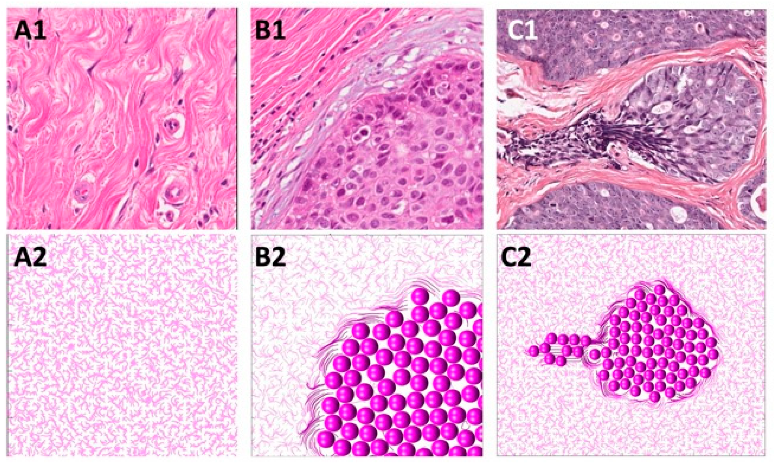 Dynamics of Fibril Collagen Remodeling by Tumor Cells: A Model of Tumor ...