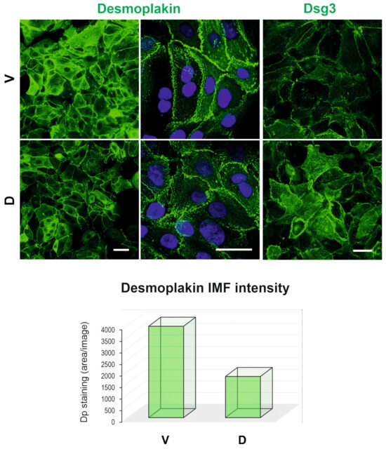 Comparative Transcriptome Analysis Identifies Desmoglein-3 as a ...