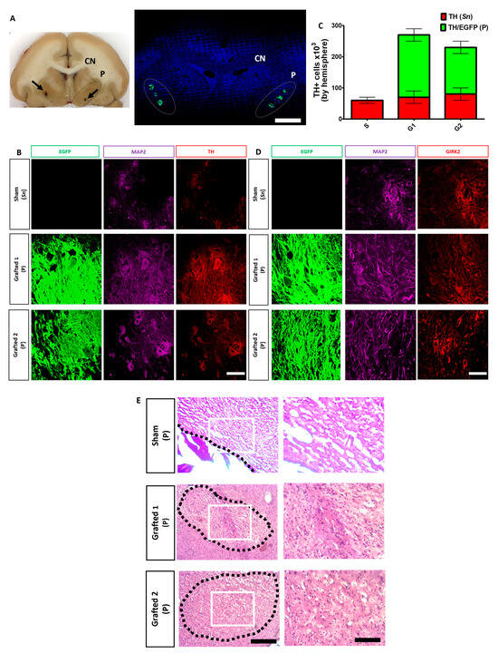 Human Embryonic Stem Cell-Derived Immature Midbrain Dopaminergic ...