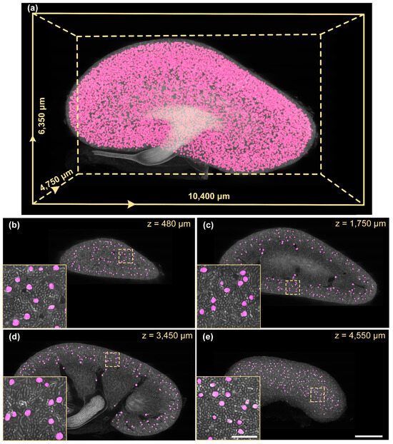 FastCellpose: A Fast and Accurate Deep-Learning Framework for Segmentation of All Glomeruli in ...