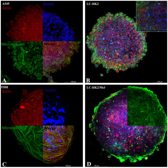 Characterization of 3D NSCLC Cell Cultures with Fibroblasts or ...