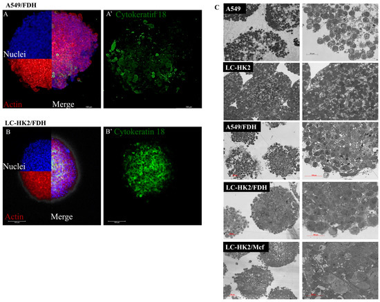 Characterization of 3D NSCLC Cell Cultures with Fibroblasts or ...