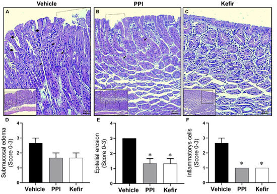 Unravelling the Gastroprotective Potential of Kefir: Exploring ...