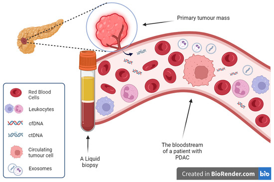 A Comprehensive Review of the Potential Role of Liquid Biopsy as a Diagnostic, Prognostic, and ...