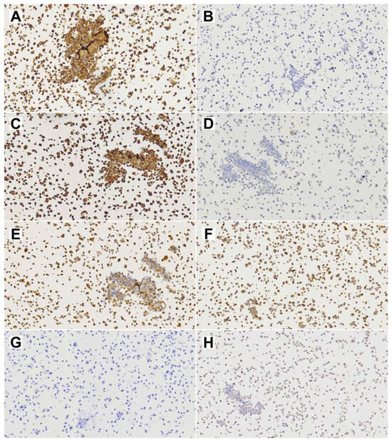 Cells | Free Full-Text | Characterization of a Preclinical In Vitro ...