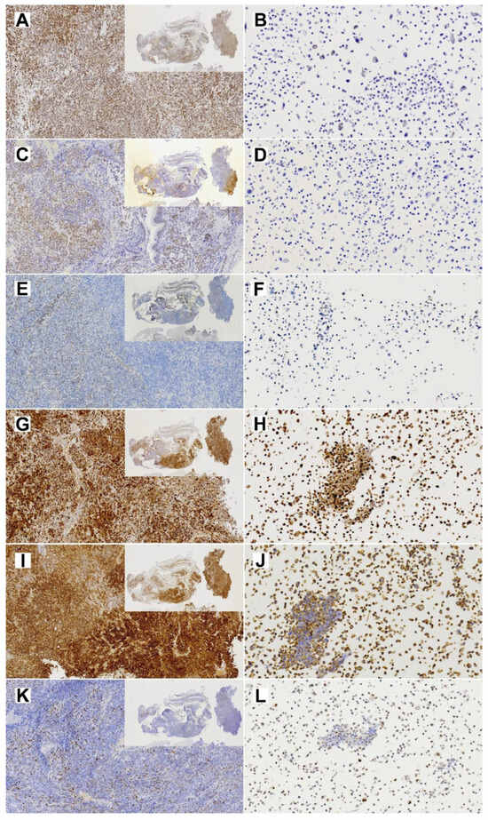 Cells | Free Full-Text | Characterization of a Preclinical In Vitro ...