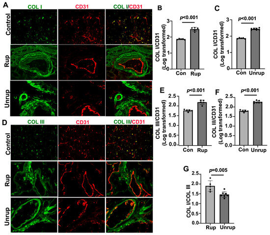 Increased Collagen I/Collagen III Ratio Is Associated with Hemorrhage ...