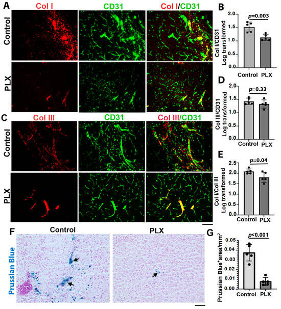 Increased Collagen I/Collagen III Ratio Is Associated with Hemorrhage ...