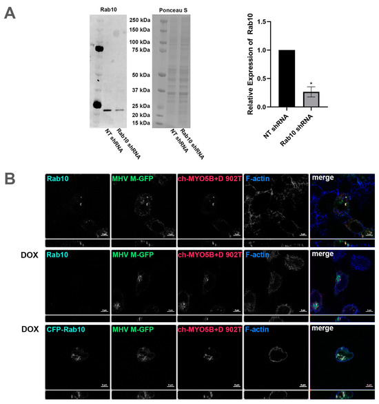 Coronavirus M Protein Trafficking in Epithelial Cells Utilizes a Myosin ...