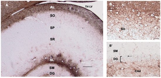 The Matrix Receptor CD44 Is Present in Astrocytes throughout the Human ...