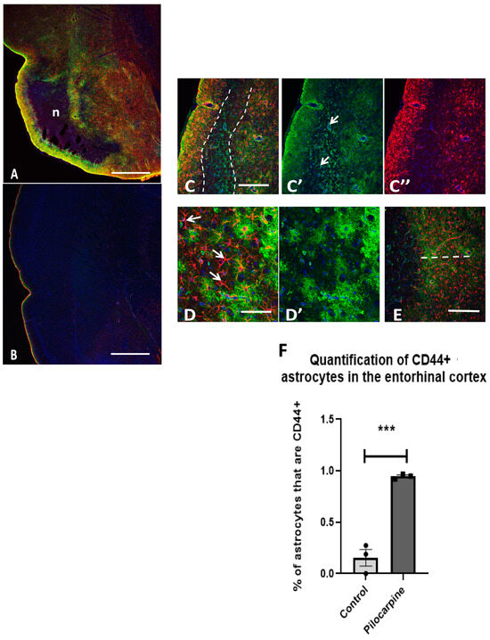 The Matrix Receptor CD44 Is Present in Astrocytes throughout the Human ...