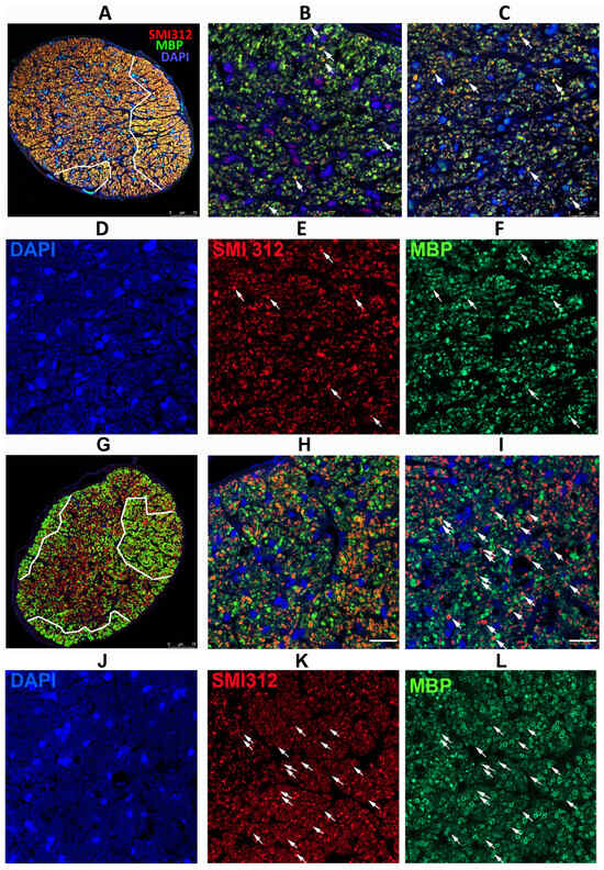 Cells | Free Full-Text | Synergistic Protection of Retinal Ganglion ...