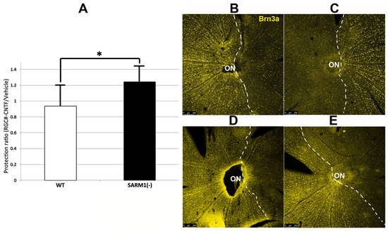 Cells | Free Full-Text | Synergistic Protection of Retinal Ganglion ...
