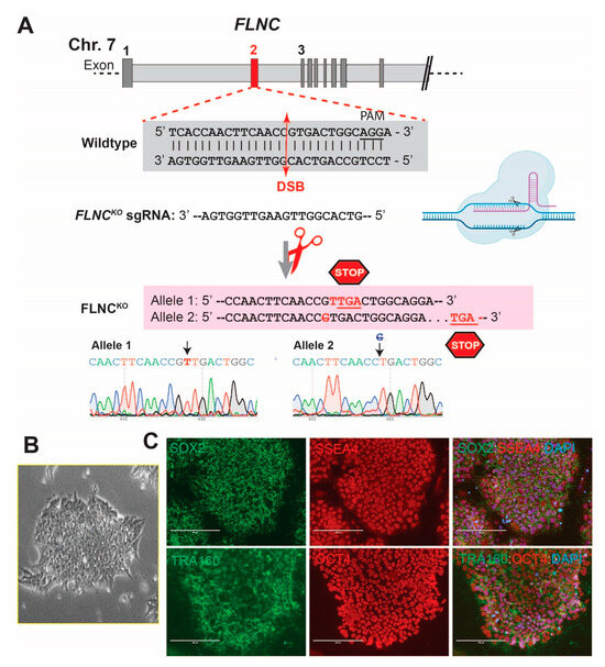 Cells | Free Full-Text | Filamin C Deficiency Impairs Sarcomere ...