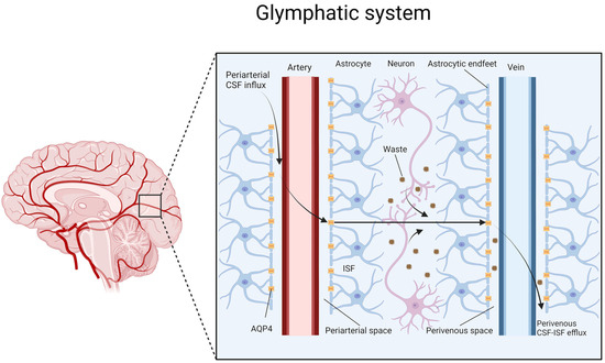 Glymphatic System Pathology and Neuroinflammation as Two Risk Factors ...
