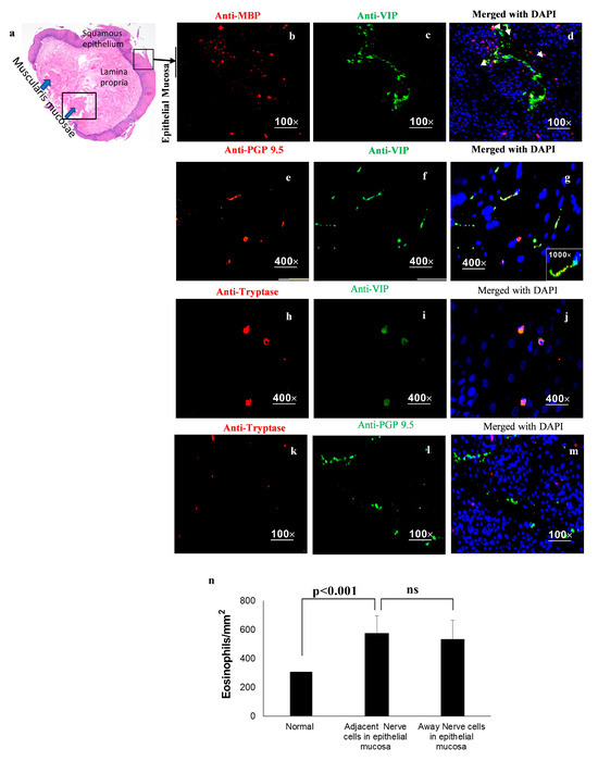 Vasoactive Intestinal Peptide Receptor, CRTH2, Antagonist Treatment ...