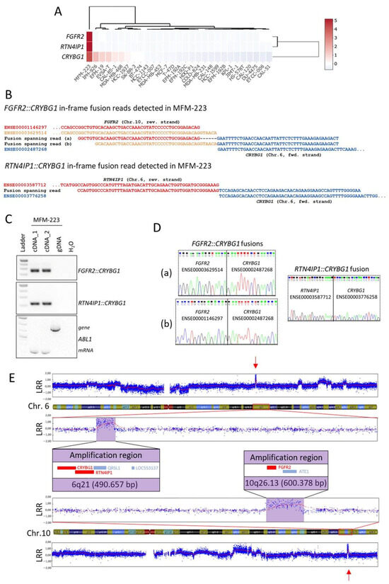 Molecular Characterization and Subtyping of Breast Cancer Cell Lines ...