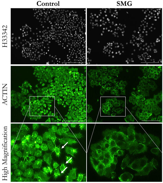 Morphological Changes of 3T3 Cells under Simulated Microgravity